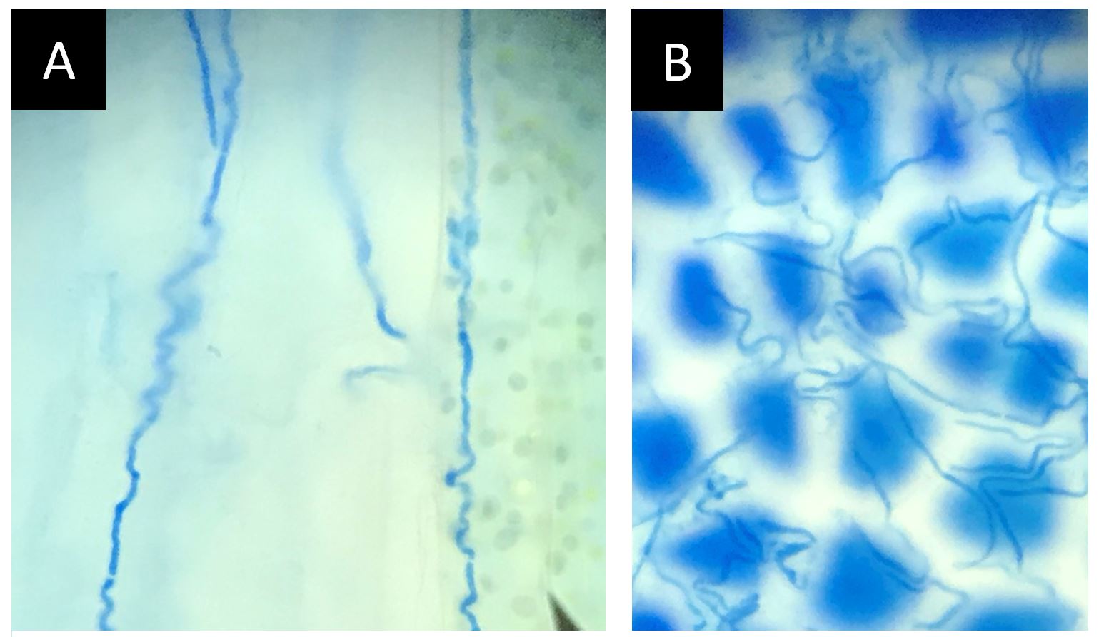 Understanding Endophytes: The history and morphology of endophytes and ...
